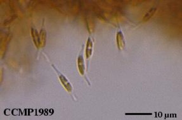 CCMP1989 | NCMA at Bigelow Laboratory