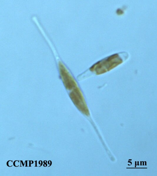 CCMP1989 | NCMA at Bigelow Laboratory