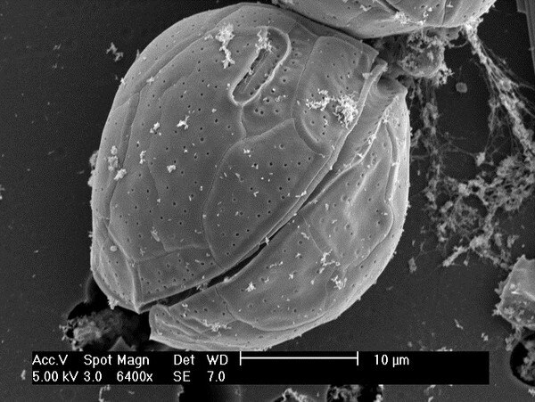 CCMP304 | NCMA at Bigelow Laboratory