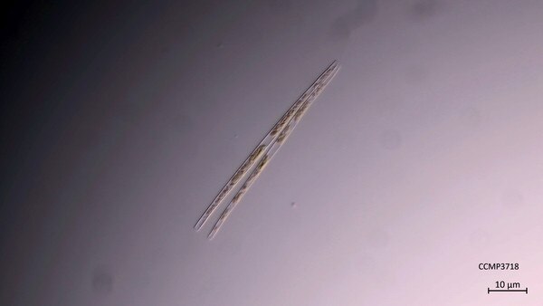 Thalassiothrix/Thalassionema sp.