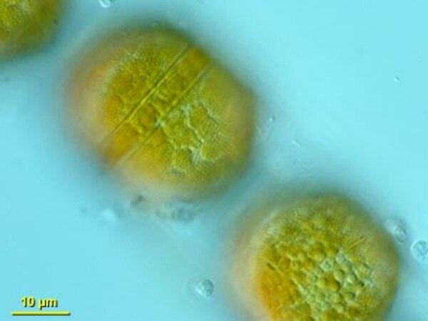 CCMP814 | NCMA at Bigelow Laboratory