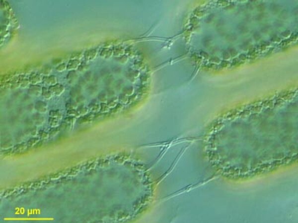 CCMP814 | NCMA at Bigelow Laboratory